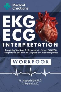 ekg/ecg interpretation: everything you need to know about the 12 - lead ecg/ekg interpretation and how to diagnose and treat arrhythmias: workbook