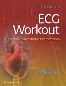 ecg workout: exercises in arrhythmia interpretation