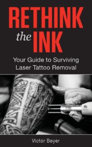 rethink the ink: your guide to surviving laser tattoo removal