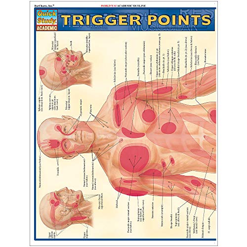 Trigger Points QuickStudy Laminated Reference Guide (QuickStudy Academic)