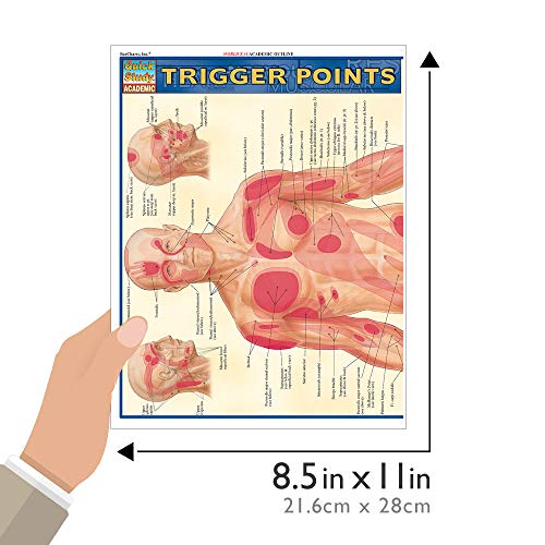 Trigger Points QuickStudy Laminated Reference Guide (QuickStudy Academic)