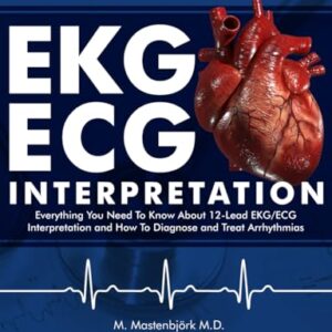 EKG/ECG Interpretation: Everything you Need to Know about the 12 - Lead ECG/EKG Interpretation and How to Diagnose and Treat Arrhythmias