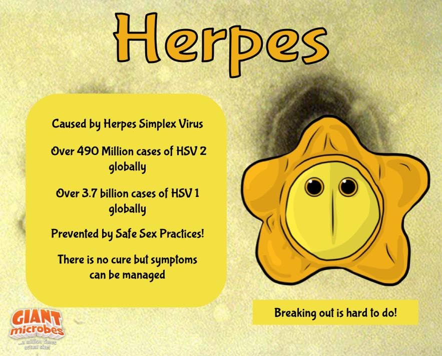 GIANTmicrobes Herpes Plush, STIs, STDs, Medical Gag Gifts Funny, OBGYN Gifts for Doctors, Infection Prevention Gifts, Infection Control Nurse Gifts