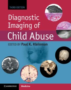 diagnostic imaging of child abuse