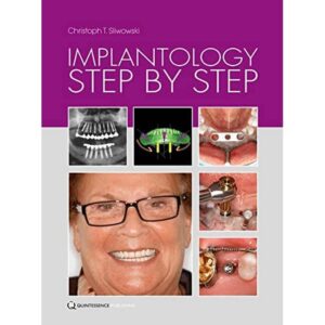 implantology step by step