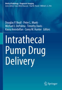 intrathecal pump drug delivery (medical radiology)