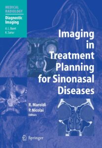 imaging in treatment planning for sinonasal diseases (medical radiology)