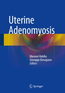 uterine adenomyosis