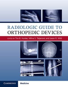 radiologic guide to orthopedic devices