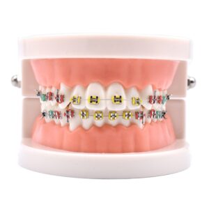 angzhili 1 piece dental demonstration orthodontic model with metal wires and bracket (metal bracket)