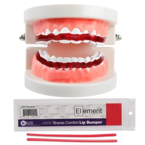 comfort cover braces guard/lip and mouth protector - snap on cover strip for braces - orthodontic/dental quality (red)