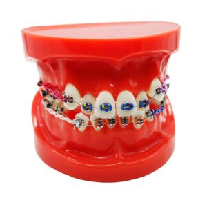 dental typodont with metal brackets orthodontic teeth model with ligature ties red