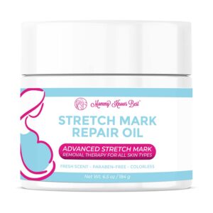 stretch mark oil cream for pregnancy & scar removal cream by mommy knows best - stretch mark remover cream & scar cream - shea & cocoa butter stretch mark cream remover for maternity skin care