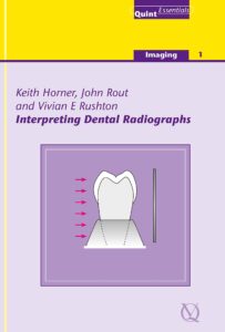 interpreting dental radiographs (quintessentials of dental practice book 5)