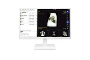 lg 24” 24ck560n-3a all-in-one fhd ips thin client for medical & healthcare with fanless & ergonomic design