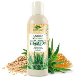 shampoo - aloe vera gel with manuka honey new zealand | great for all hair & skin types | gentle soothing relief for eczema, psoriasis, dry itchy flaky scalp, damaged hair - 8oz