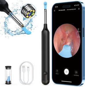 earwax camera ear camera otoscope cleaner, oxbird 1080p wireless ear wax removal kit smart ear cleaner with camera and light for iphone, ipad & android smart phones (black)