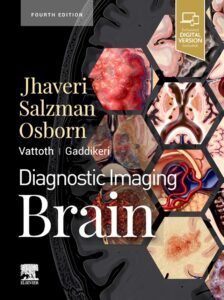 diagnostic imaging: brain: diagnostic imaging: brain e-book