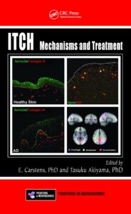 itch: mechanisms and treatment (frontiers in neuroscience book 56)